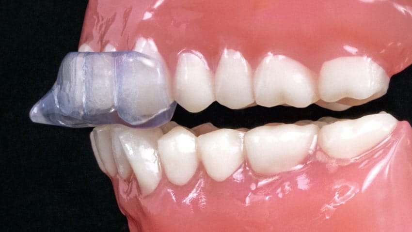 Dental Technology – My Hills Dentist